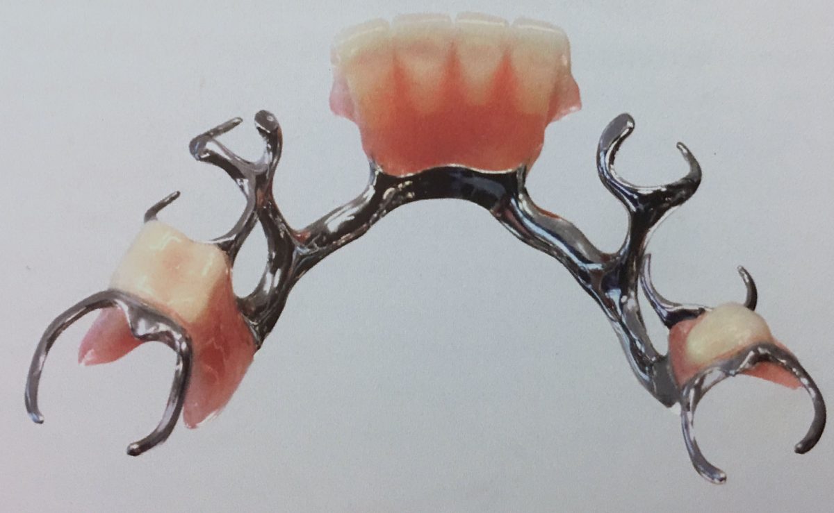 Zahnersatz • Zahnarzt Dr. Springer, Berlin Pankow